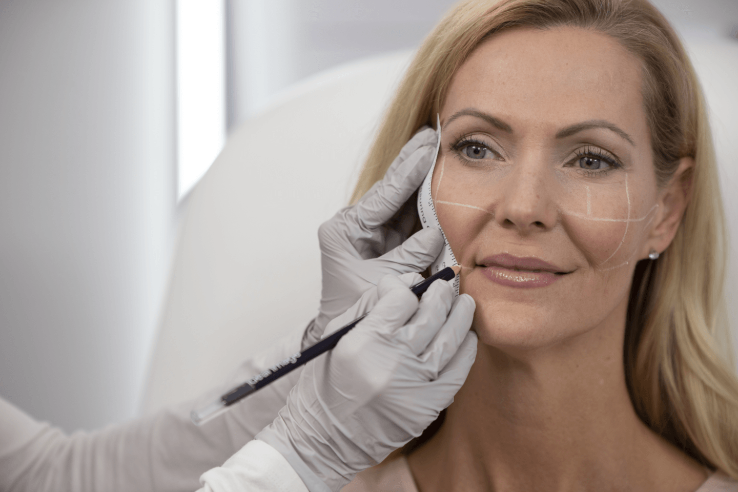 Dermal Fillers 101: What Are They, Benefits, & More | Ideal Image